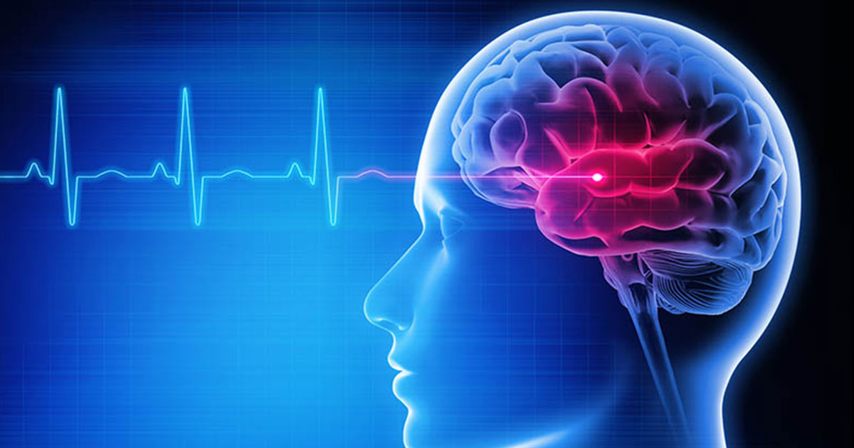 Recognizing the Warning Signs and Symptoms of a Stroke - Usman Memorial ...
