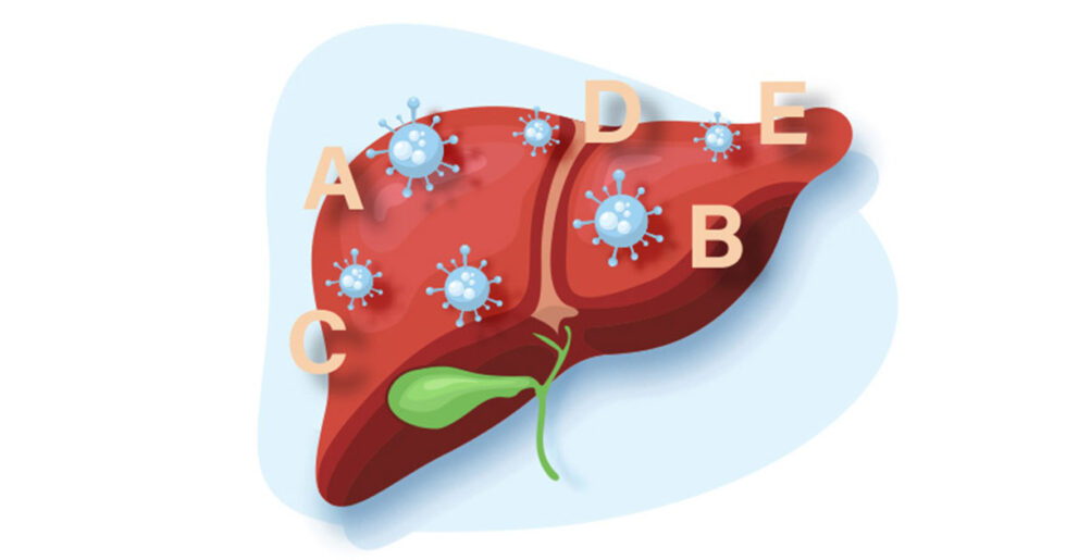 What Are The Signs and Symptoms of Hepatitis? All Types Explained ...